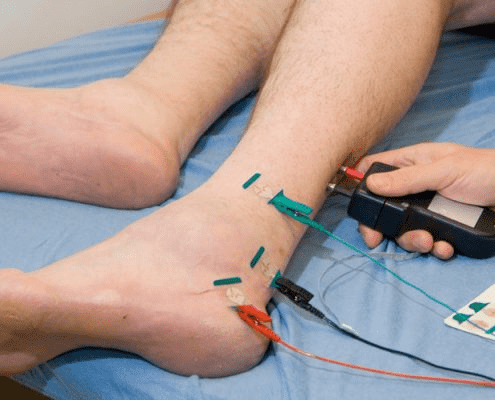 نوار عصب و عضله اطفال (EMG) چیست؟بهترین مرکز نوار عصب و عضله