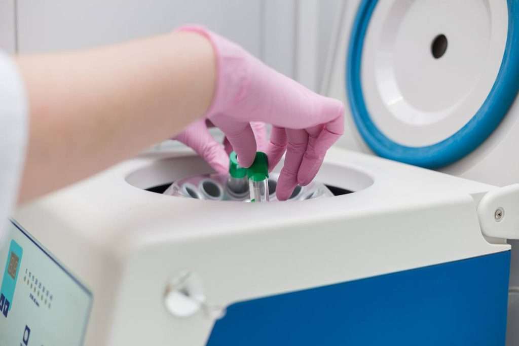 تزریق پی آر پی زانو در درمان زانو درد ومفاصل - هزینه ها 1402