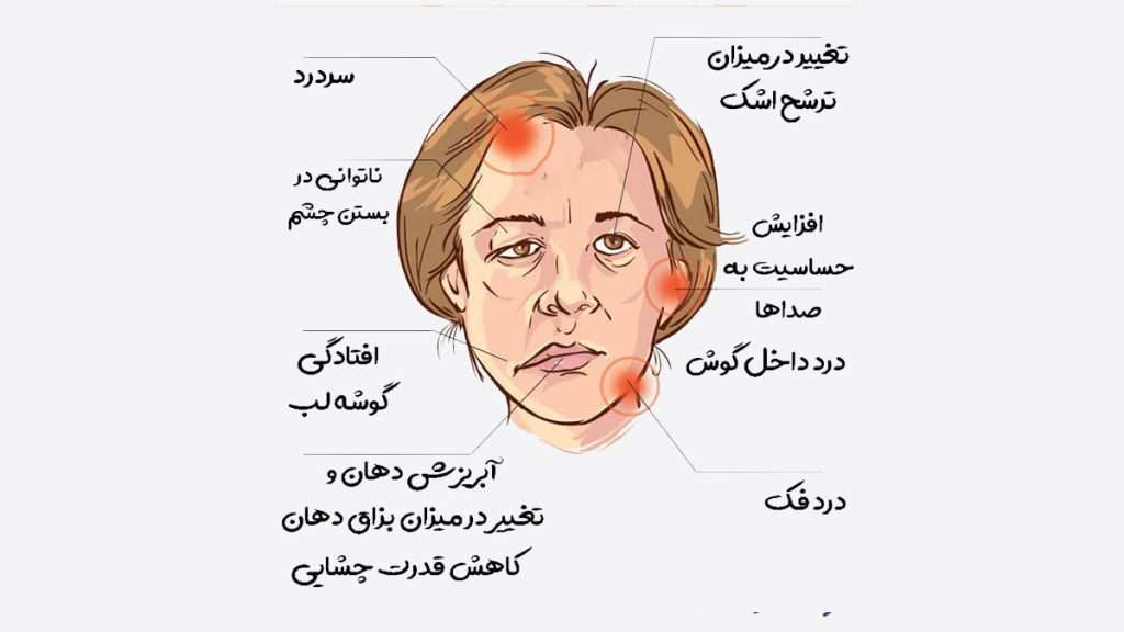 فلج بلز و درمان فلج بلز به همراه 10 تمرین - دکتر مهسا موسوی