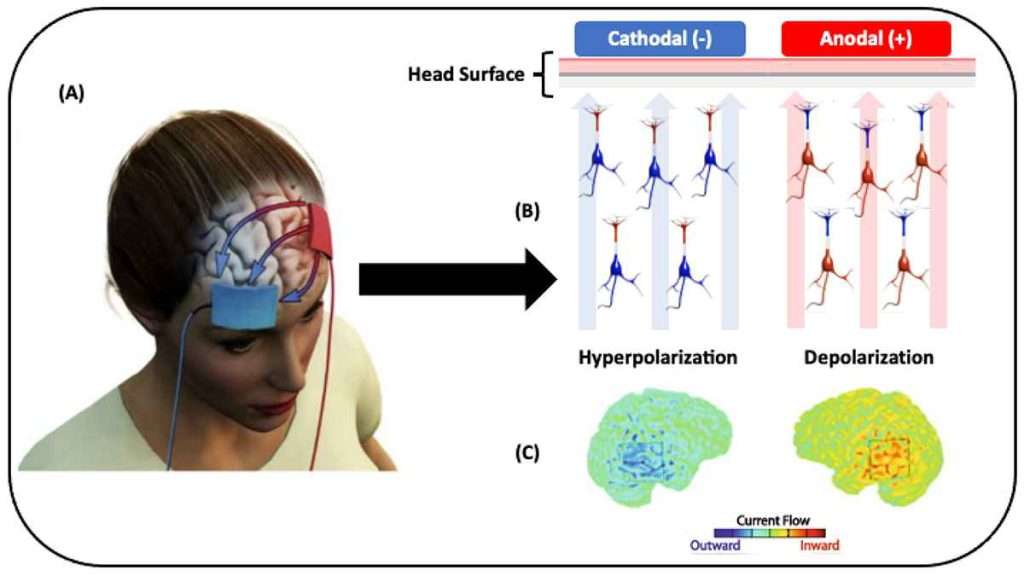 تحریک الکتریکی مغز Tdcs چیست؟کاربرد تحریک الکتریکی مغز 1403