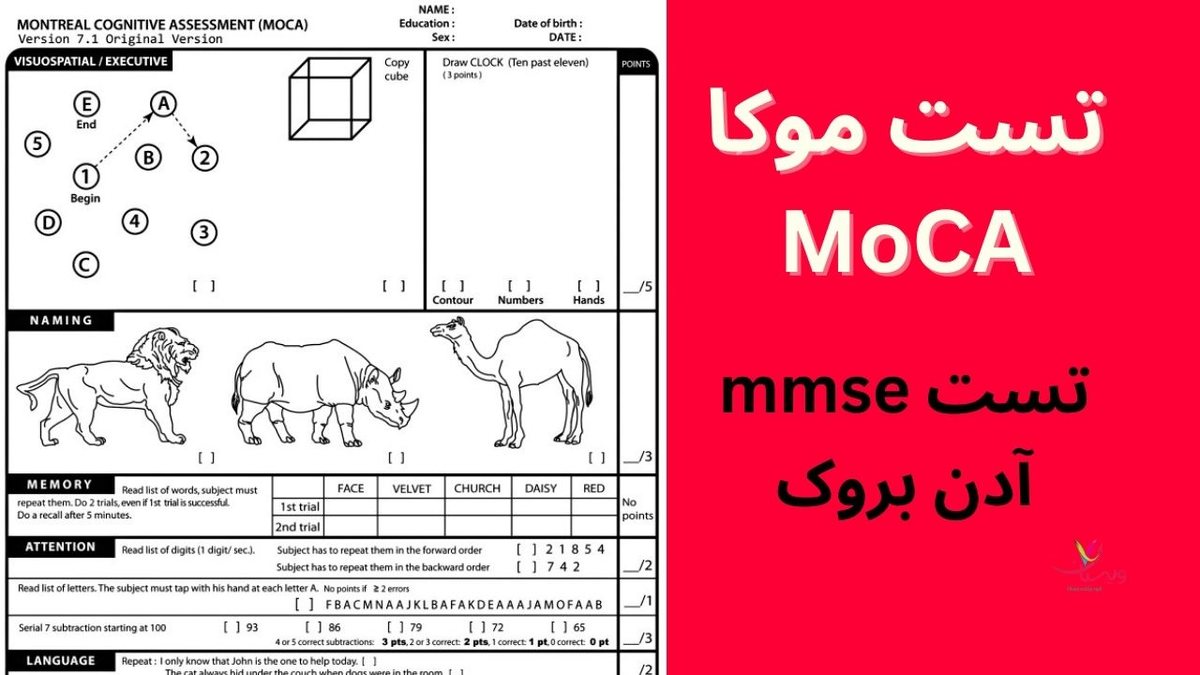 آزمون های شناختی، تست موکا MoCA , آدن بروک , دمانس📝
